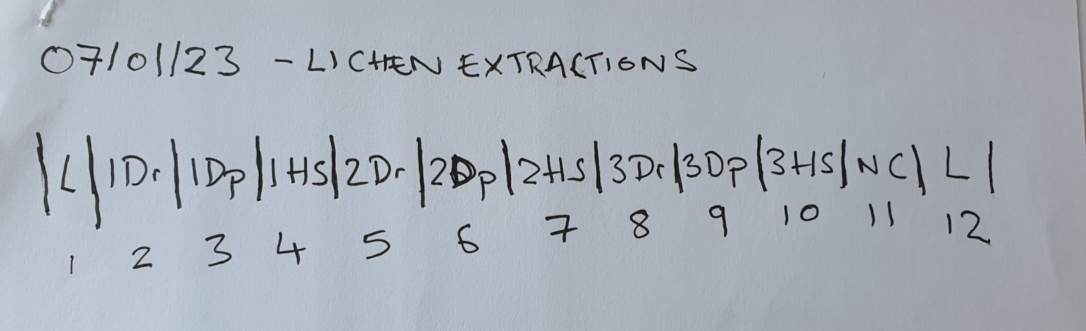 Interpreting Electrophoresis Gels | Bento Lab