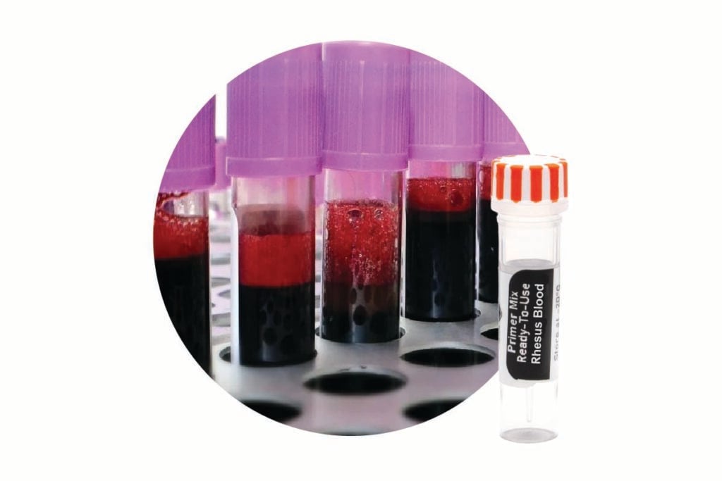 Rhesus Blood Group Primer Mix for PCR Learning Project